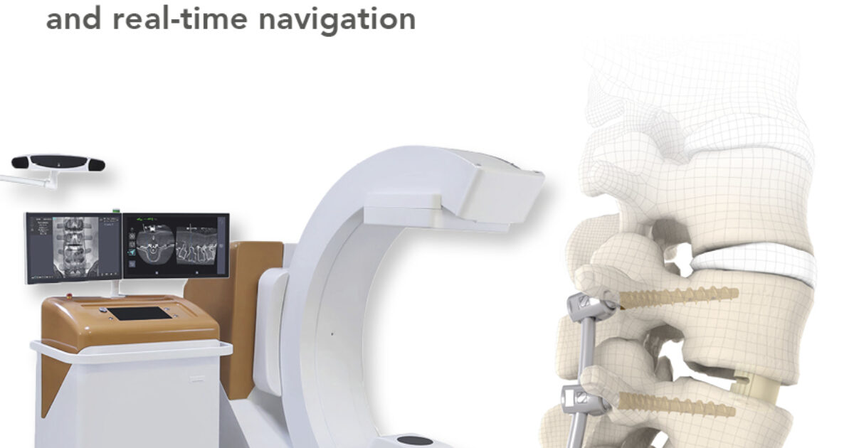 SIGNUS et eCential Robotics annoncent un partenariat…